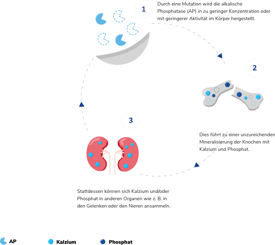 Hypophosphatasie (HPP)